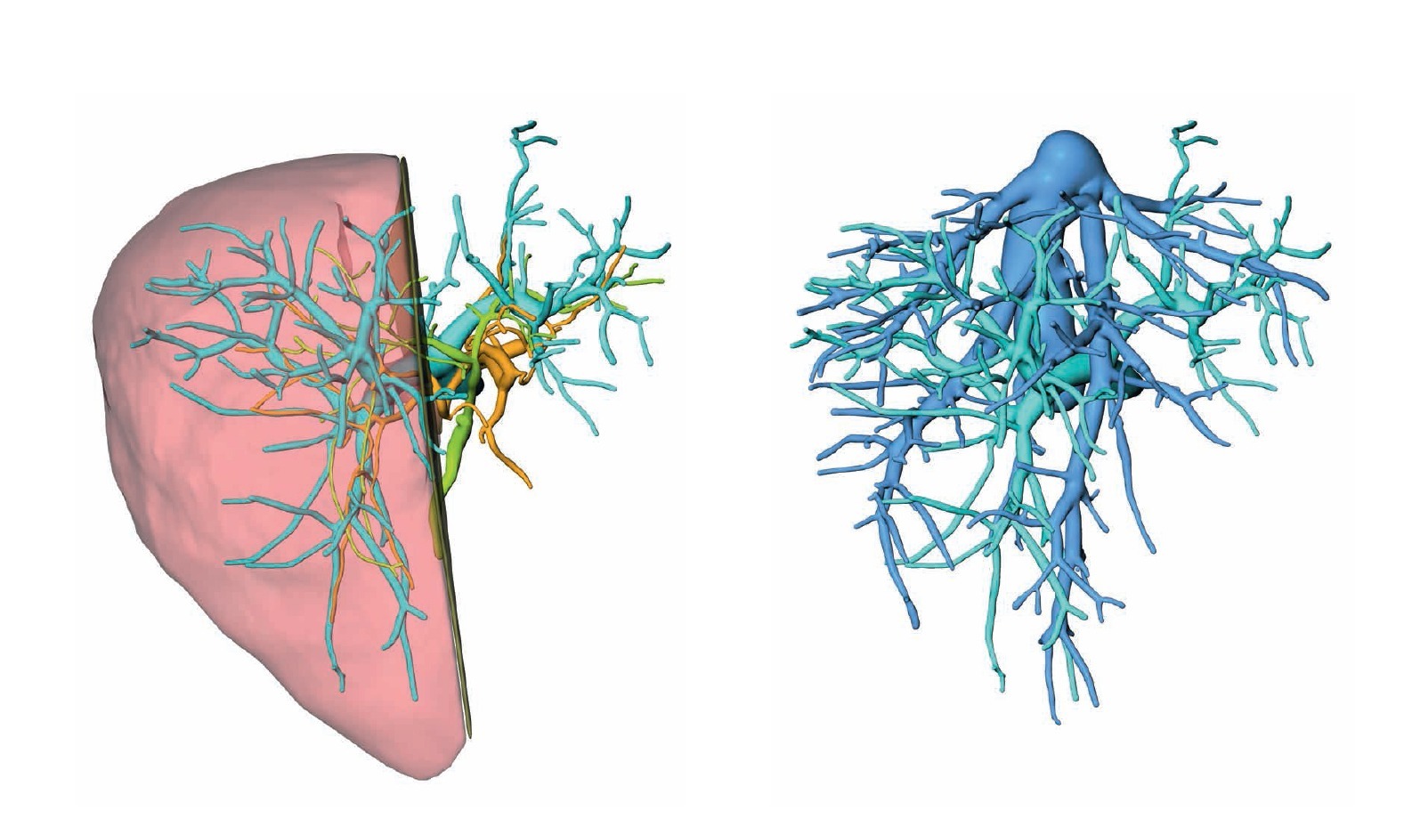 Advanced AI Liver Imaging & 3D Visualization | ARJ Medical
