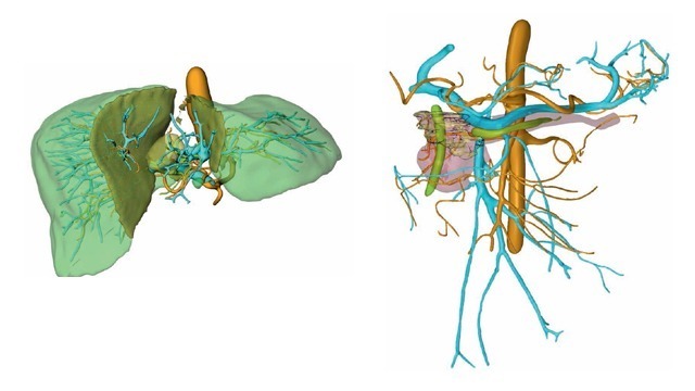 Advanced AI Liver Imaging & 3D Visualization | ARJ Medical